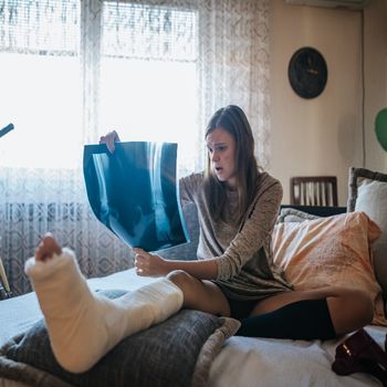 Bone Fractures After An Accident Take to Heal? - Dr. Jesu Jacob